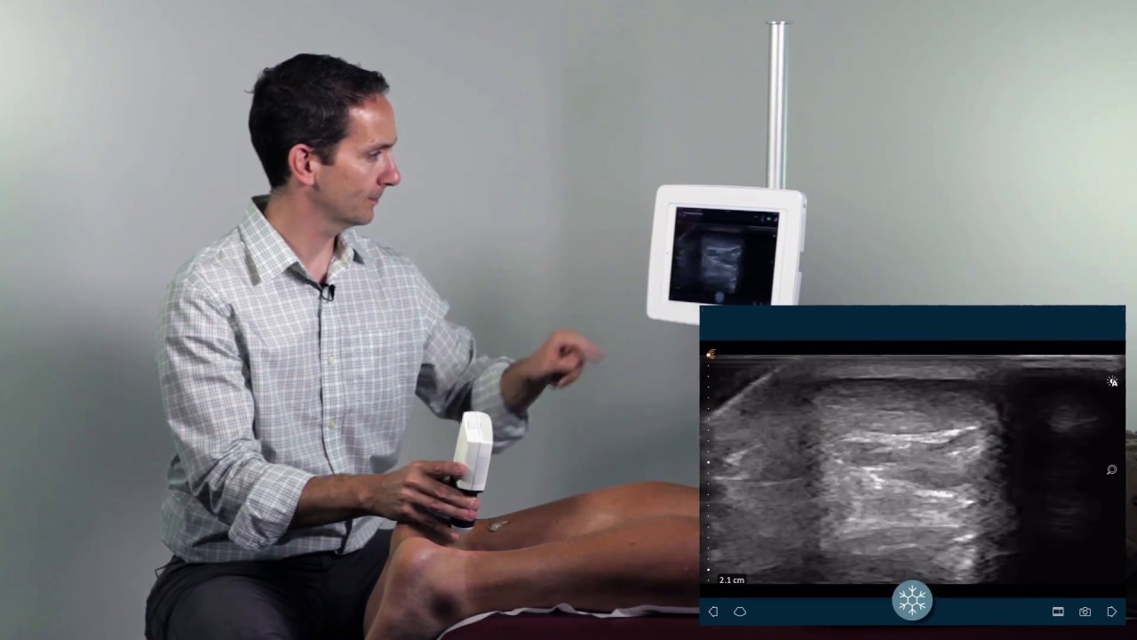Chris Eddy's Achilles Tendon Ultrasound Exam - YouTube