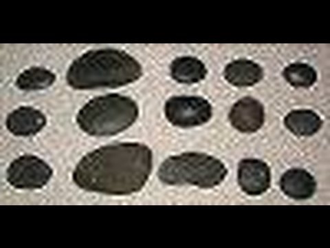 RE: Gallstones Referred Pain? - YouTube