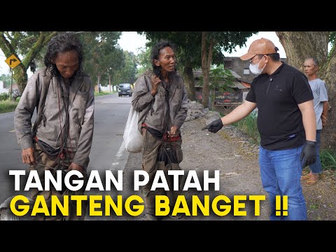 KAMI PANIK !! TANGAN ODGJ INI PATAH, LIHAT APA YANG TERJADI SETELAH DIBERSIHKAN !!