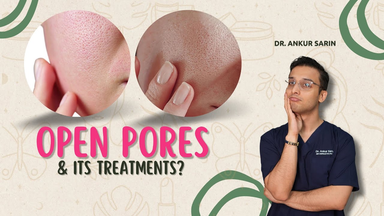 Minimize open pores | Open pores कैसे कम करें | | Open pores skincare ...