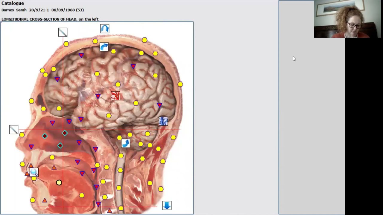 Example of Detailed Scan - YouTube