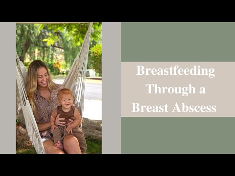 Breastfeeding Through a Breast Abscess: The Story of How one Woman Continued to Breastfeed