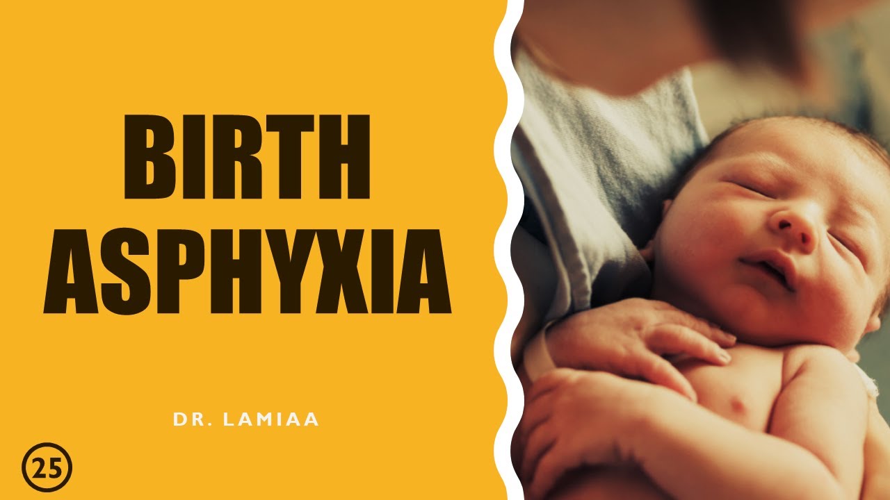 Birth Asphyxia Dr. Lamiaa Lecture 25 - YouTube
