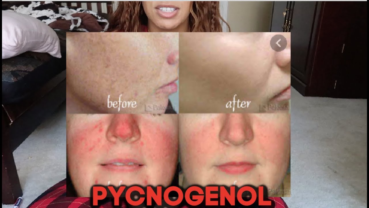 Thinking About Adding Pycnogenol To My Regimen - YouTube