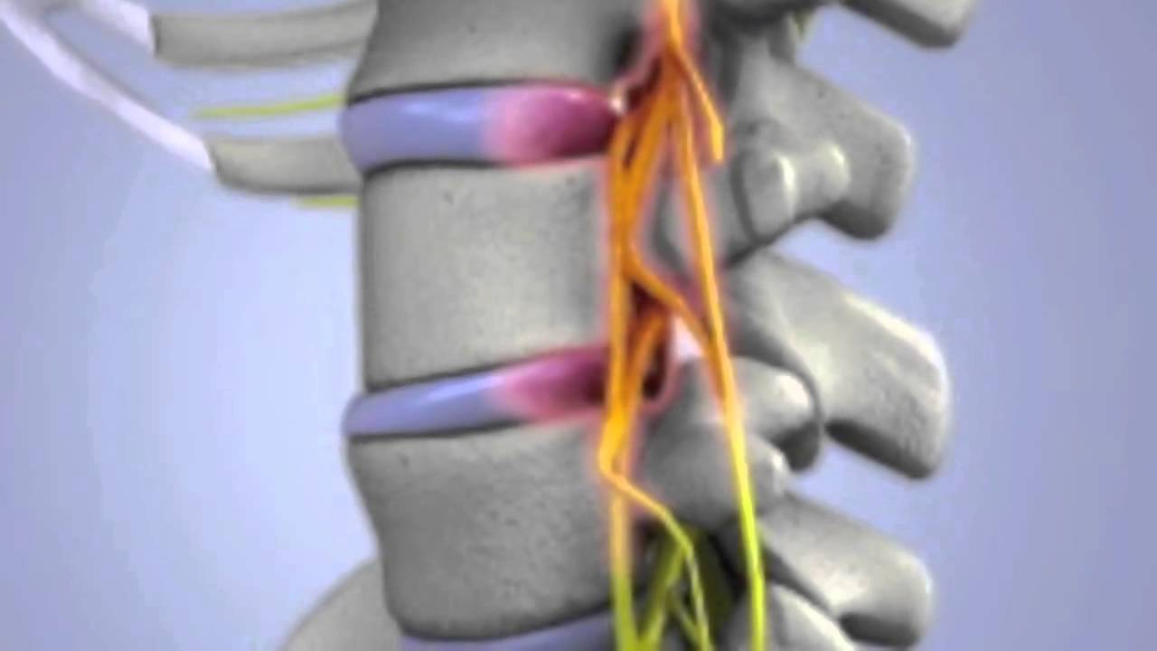 Chiropractor, Dr Edward Beck Explains Chiropractic and The Big Idea ...