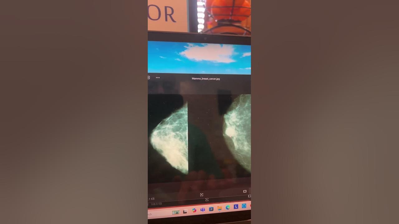 Demystifying Radiology 4 - YouTube