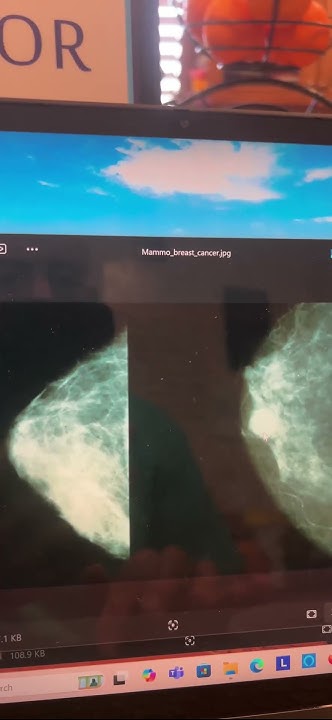 Demystifying Radiology 4 - YouTube