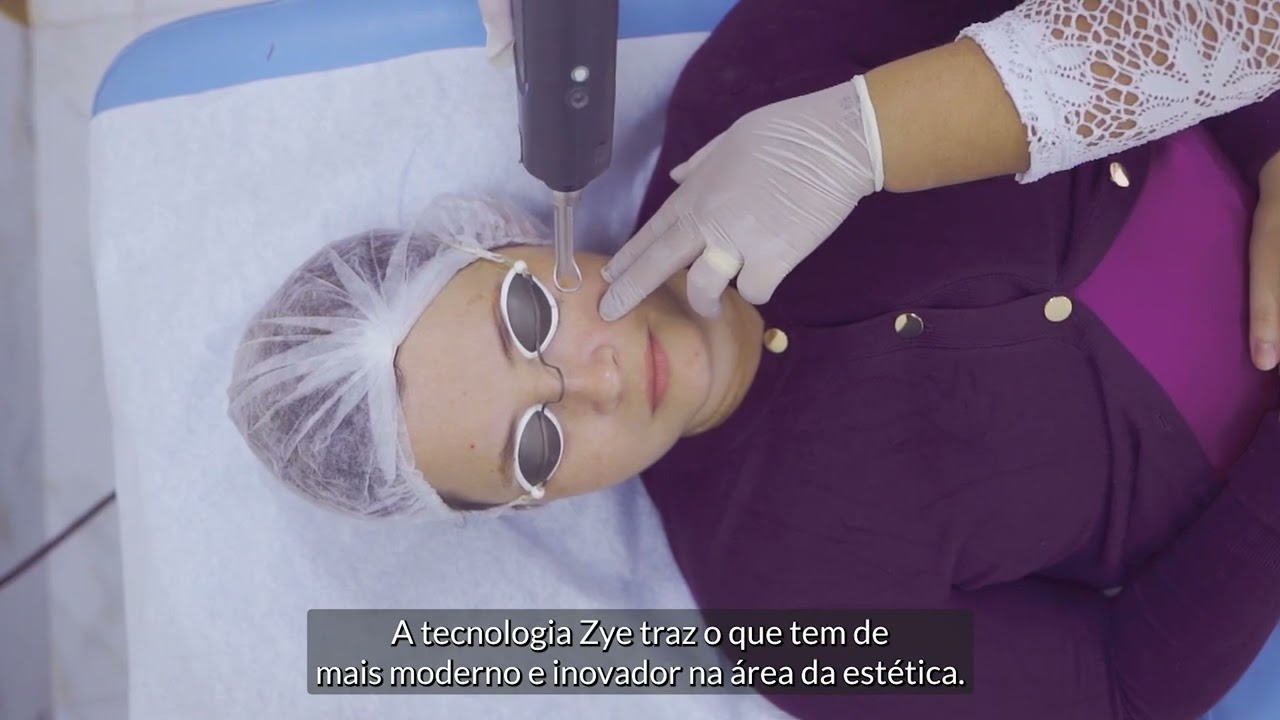 Tratamento para olheiras com Zye Laser - YouTube