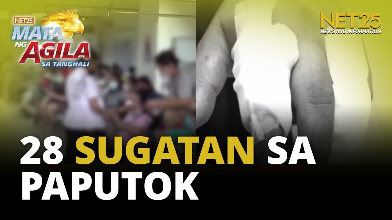 28 sugatan dahil sa paputok — DOH - YouTube