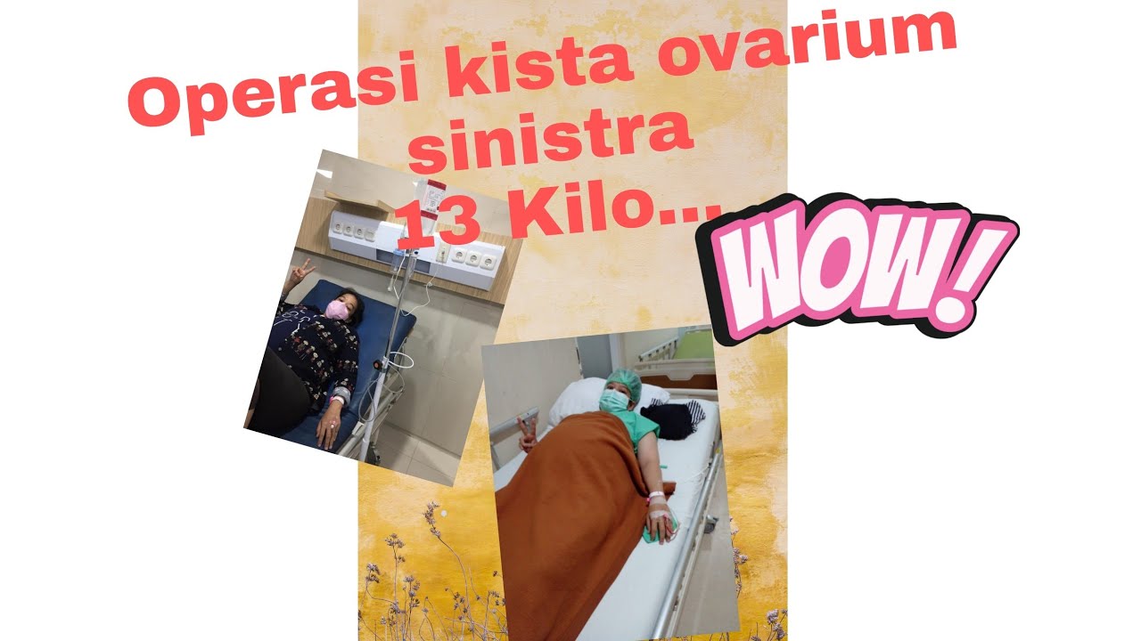 OPERASI KISTA OVARIUM SINISTRA. - YouTube