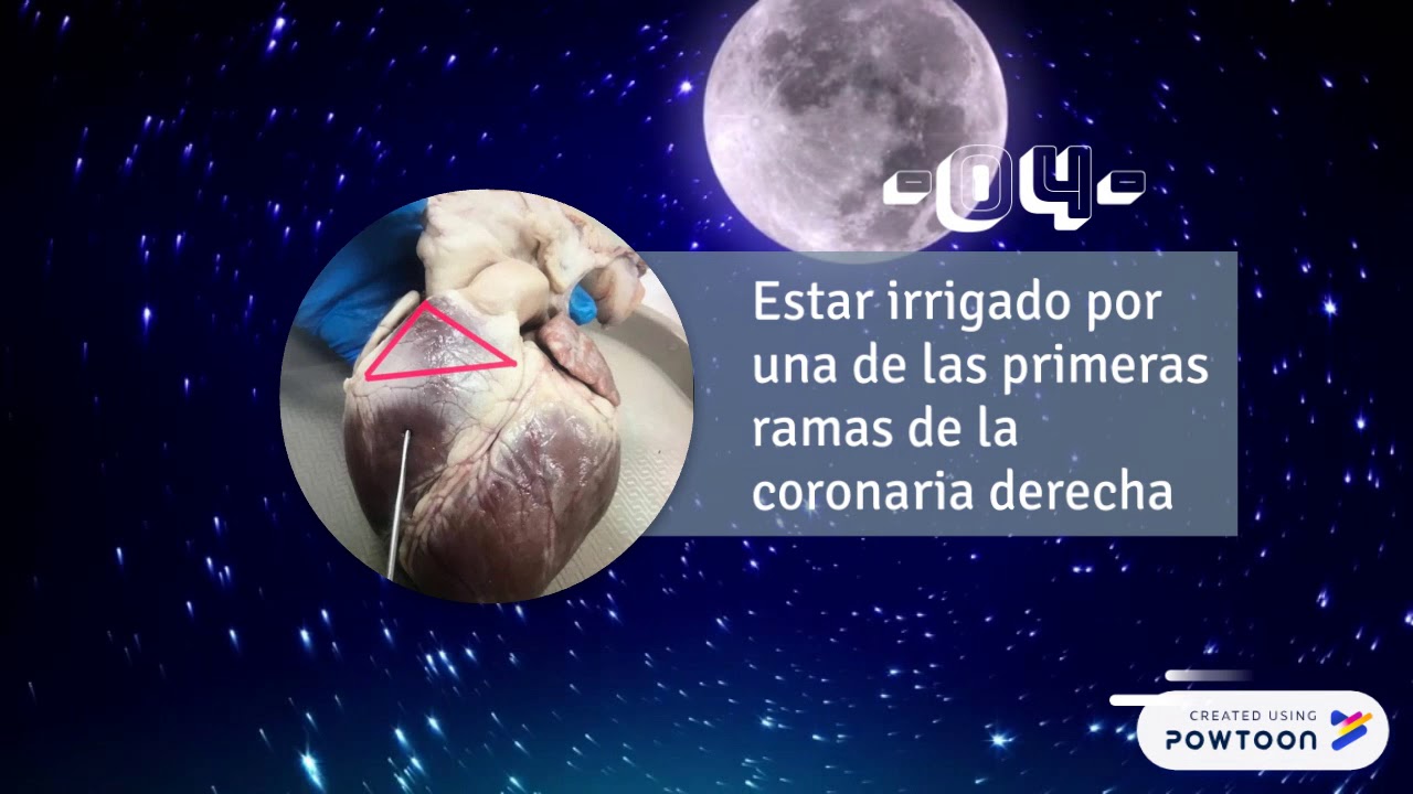 Cono Arterioso - YouTube