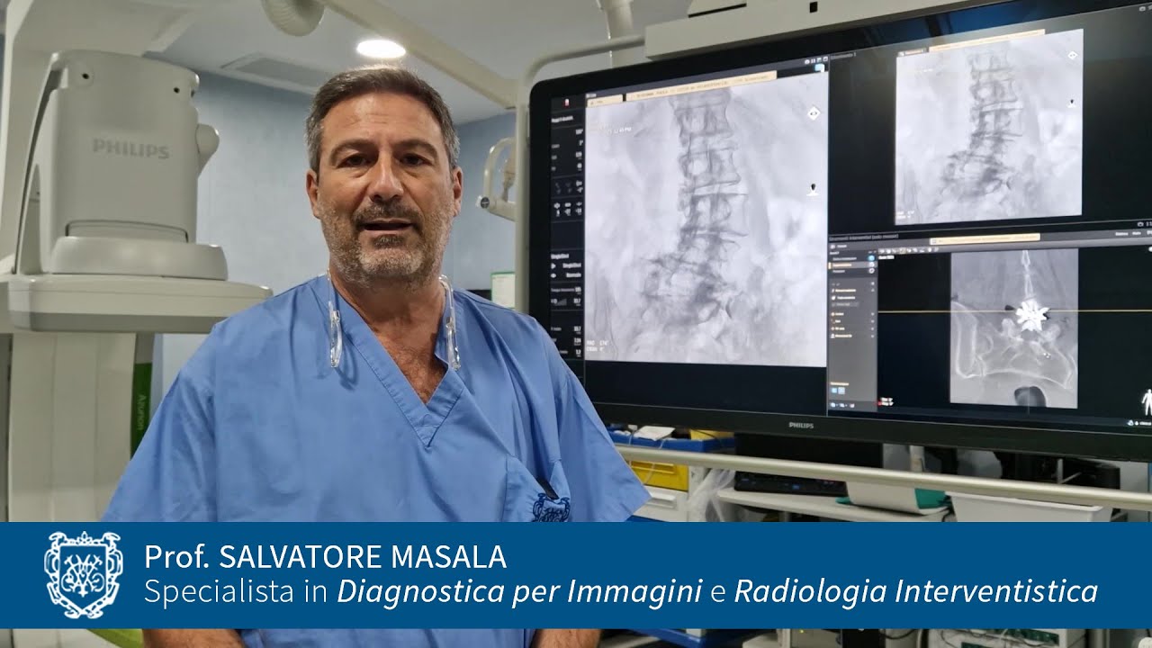 Prof. Salvatore Masala, Stenosi lombare e distanziatori interspinosi ...