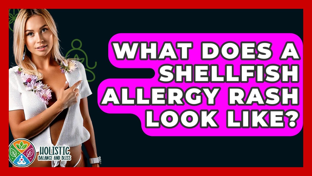 What Does A Shellfish Allergy Rash Look Like? - Holistic Balance And ...
