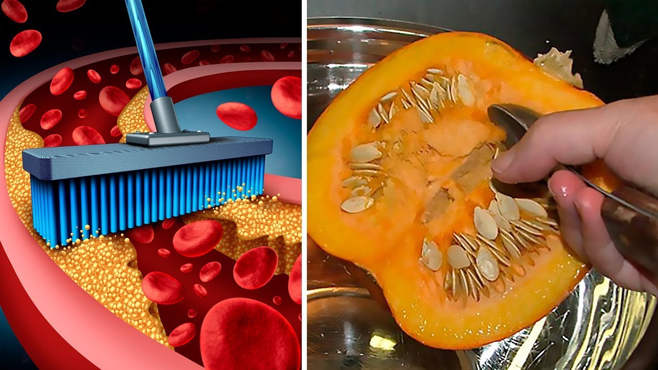 How To Lower Cholesterol, Blood Glucose, Lipids, and Triglycerides ...