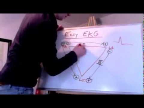 Easy EKG: Einthoven's Triangle - YouTube