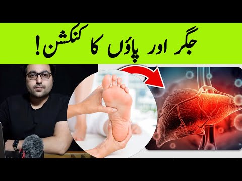 Dr. Zee:How Your Feet Are Warning You About Your Liver Problems | जिगर और पैर का कनेक्शन