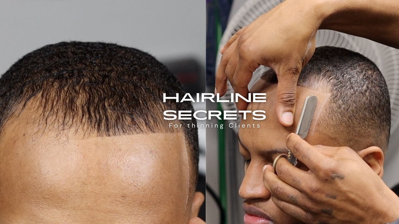 | HAIRCUT TUTORIAL | How to Transform Your Thin Hairline: Insider Tips ...