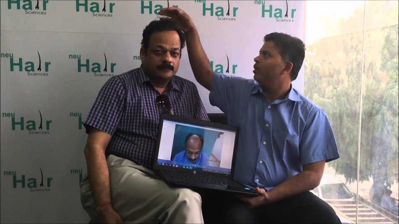 Amazing density with DHT technique by Dr Pradeep Sethi, MD (AIIMS, New ...