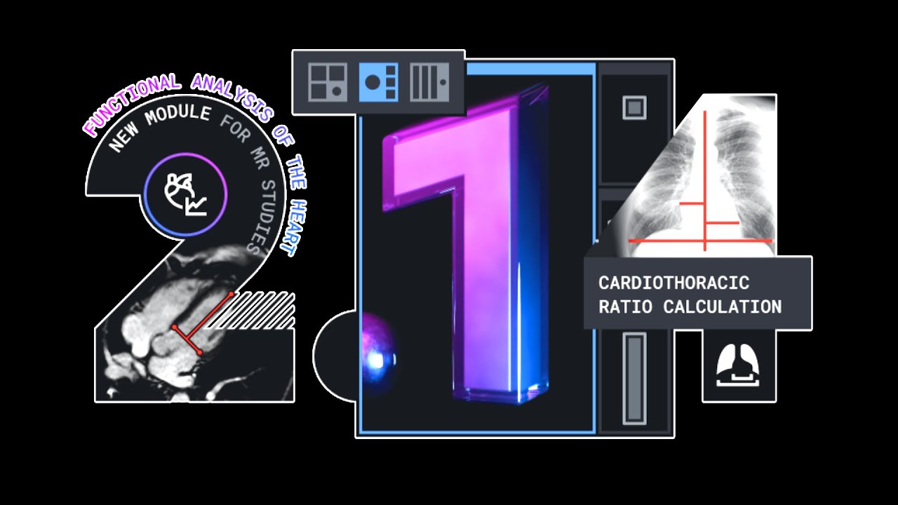 New features of Inobitec DICOM Viewer 2.14 - YouTube