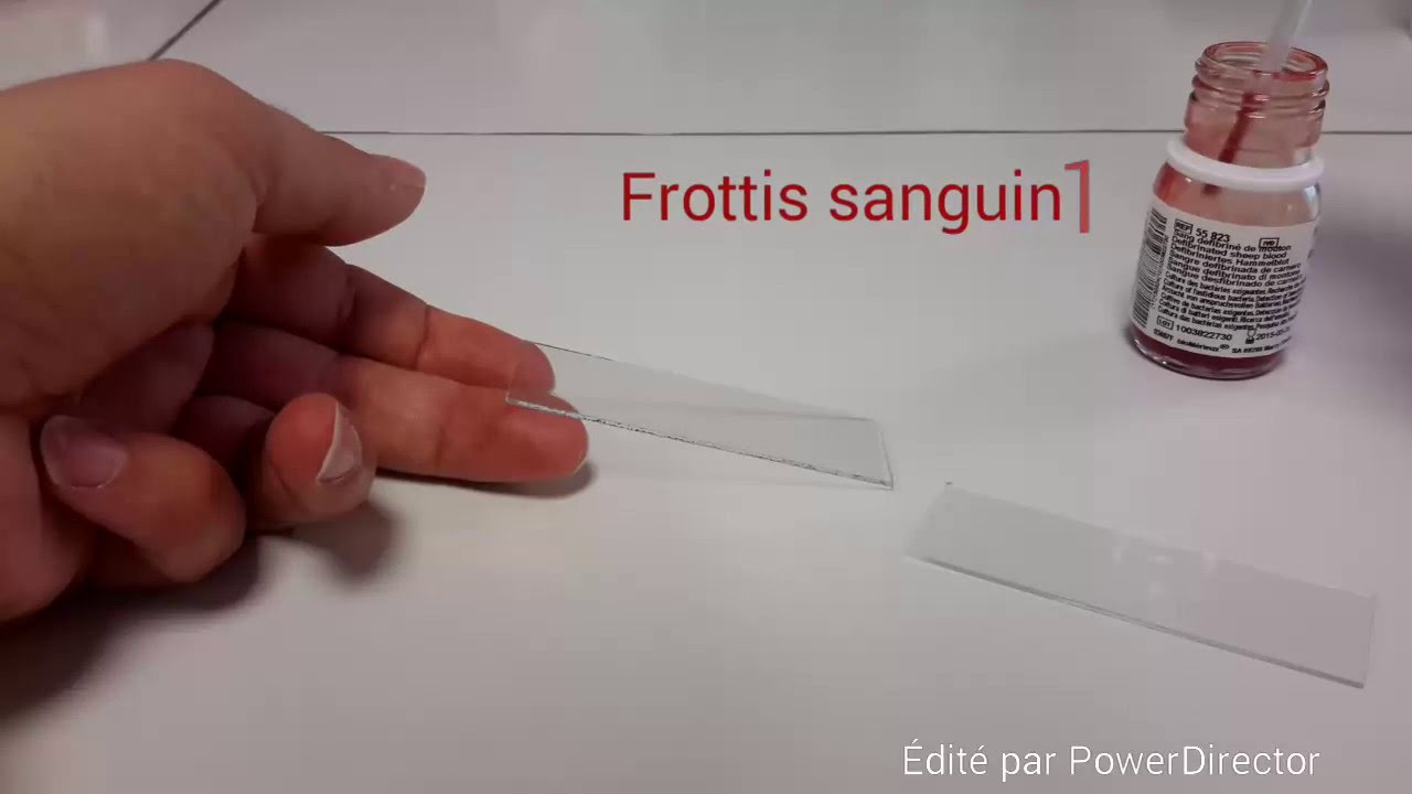Protocole frottis sanguin - YouTube