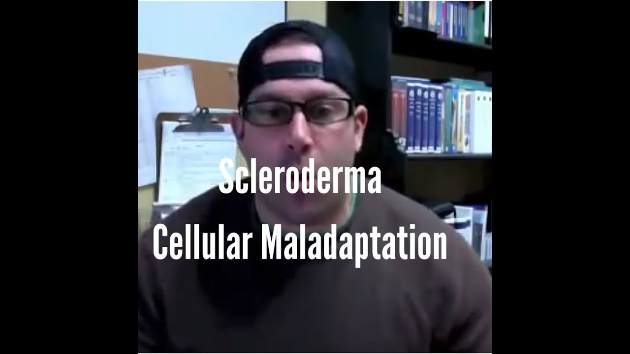 Scleroderma - Cellular Maladaptation - YouTube