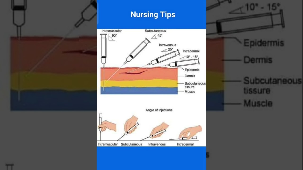 Angles of Insertion of Injection IM/SC/IV/ID #nurse #tips #medical ...