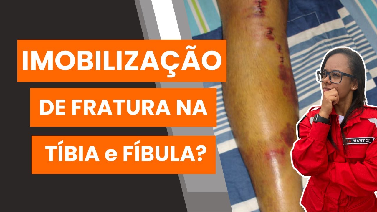 Você sabe fazer uma IMOBILIZAÇÃO de FRATURA na TÍBIA e FÍBULA? 🏥💪 - YouTube