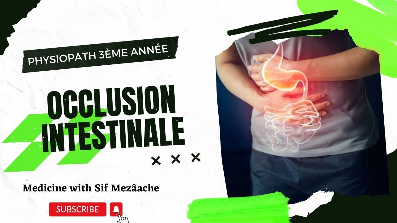 4/ Occlusion Intestinale | Physiopath 3éme MED - YouTube