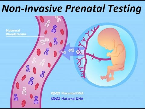 NIPD test: генетический тест по беременности Trisomy 13, 18 и 21 - YouTube