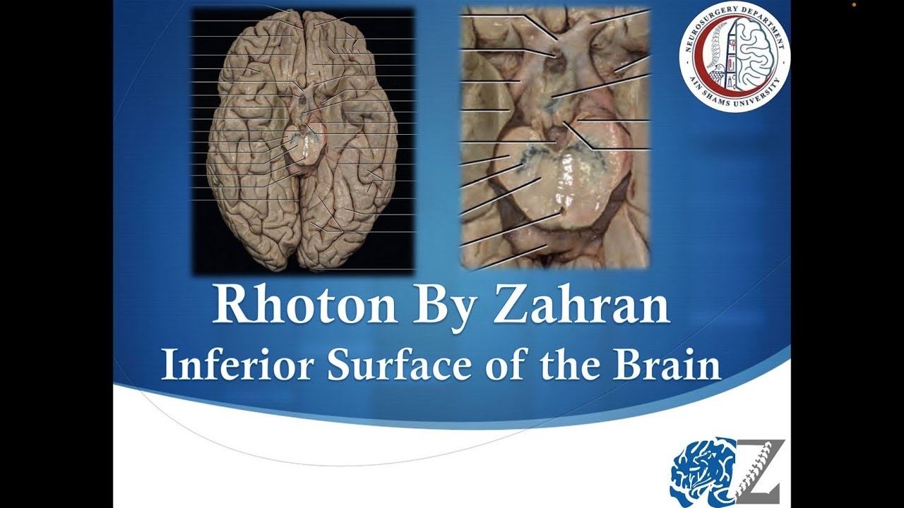 Rhoton By Zahran (6): Inferior Surface of the Brain - YouTube