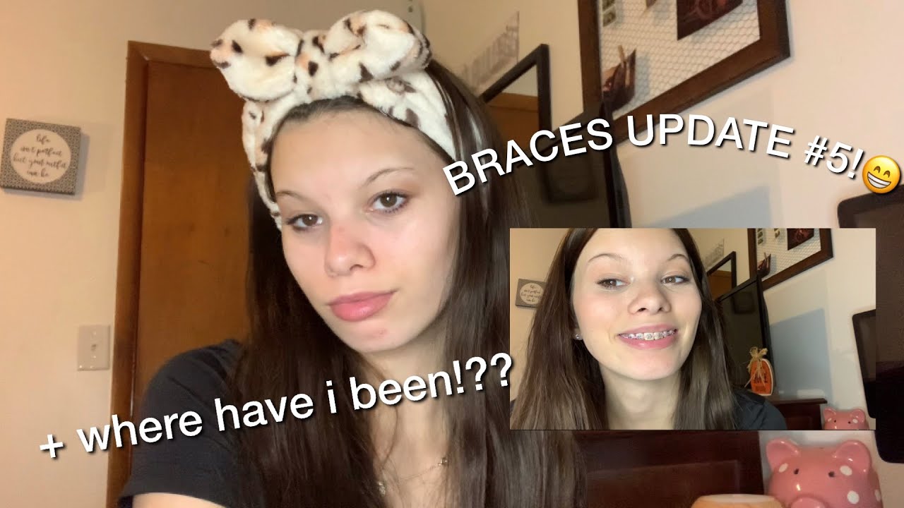 BRACES UPDATE! +life update! - YouTube