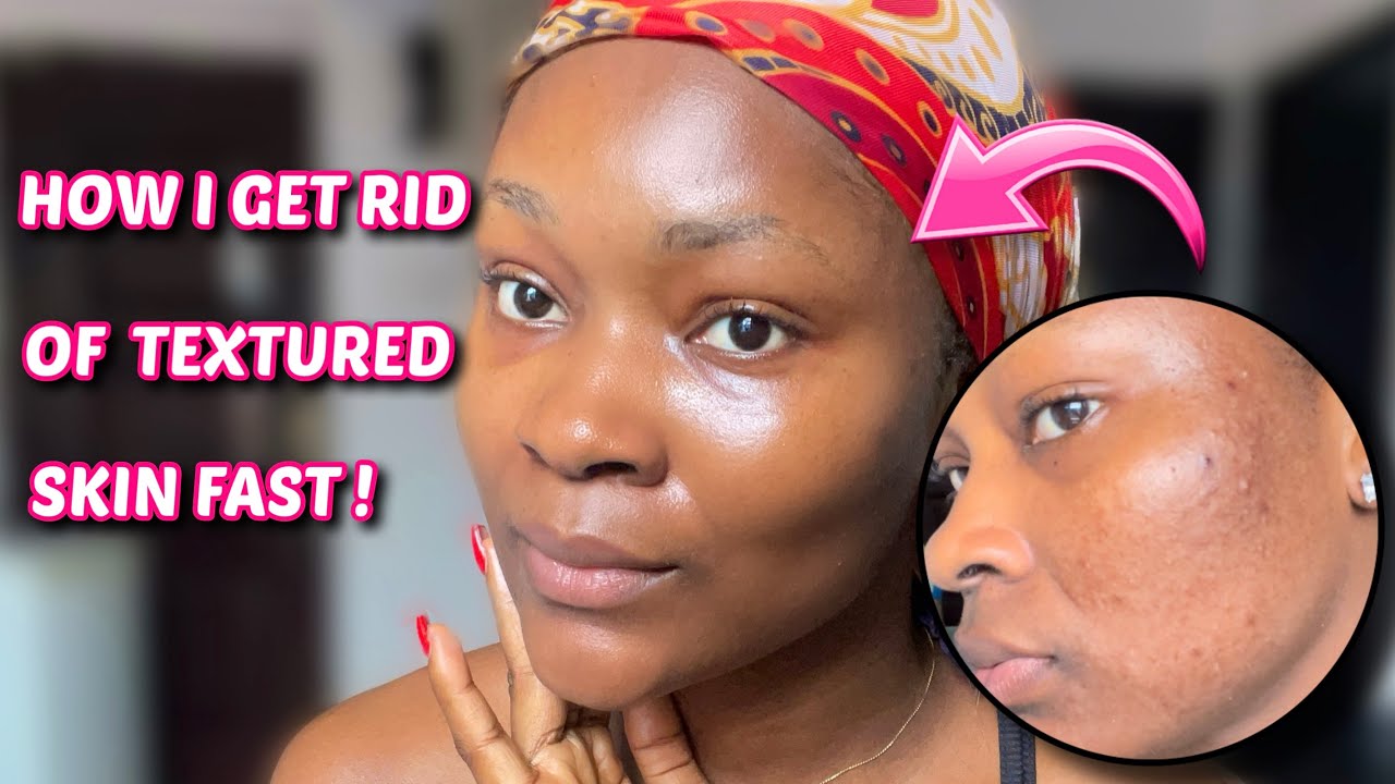 HOW I GET RID OF TEXTURED SKIN ON MY FACE FAST ! | Affordable products ...