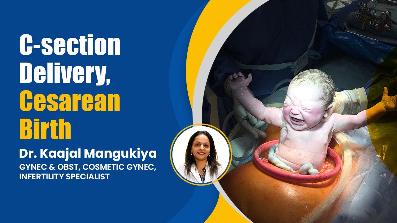 C-section Delivery, Cesarean birth, Safe and reliable Cesarean section ...