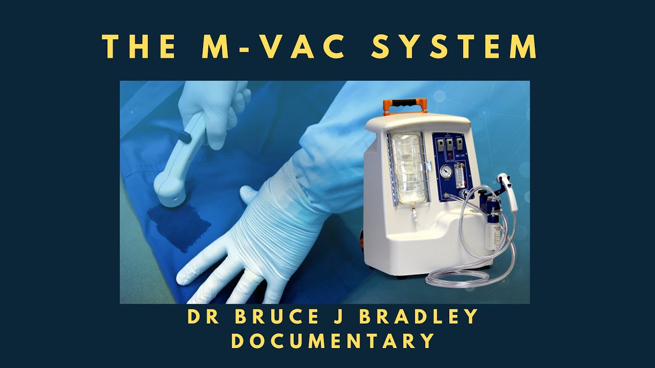 The M-Vac System - Extraordinary Forensic DNA Collection Tool and the ...
