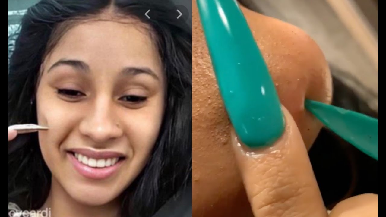 Cardi B & Offset Dr. Pimple Popper - YouTube