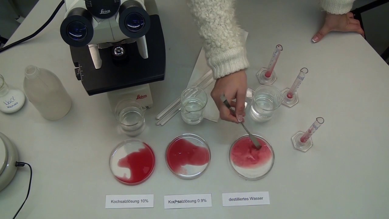 Hämolyse des Blutes - YouTube
