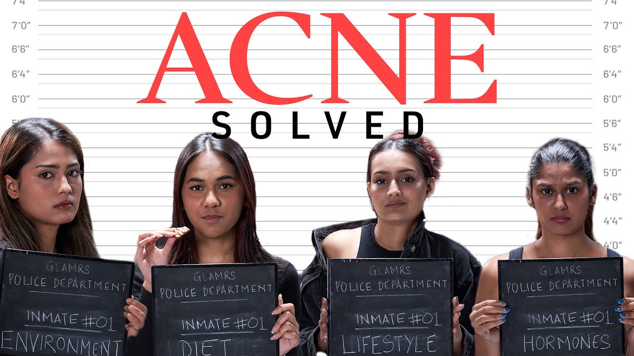 ACNE INVESTIGATION SOLVED! What's causing your acne? | Find out today ...