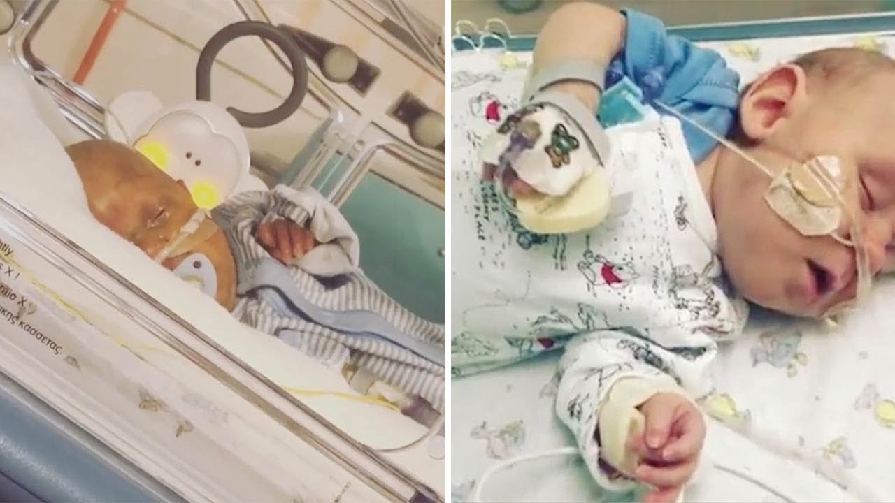 Newborn Baby Is The Size Of A Hospital Needle - YouTube