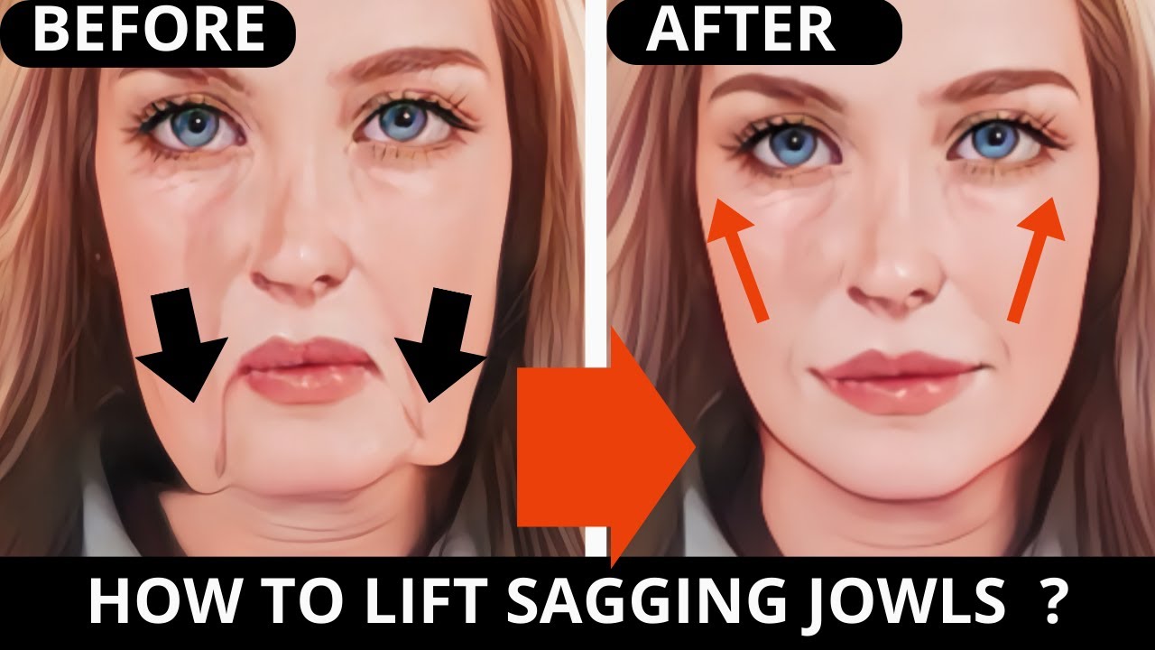 ANTI-AGING FACE EXERCISES FOR JOWLS AND LAUGH LINES !| SAGGY CHEEKS ...