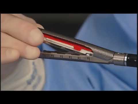 Entrenamiento Echelon flex 60 Endopath Ethicon/J&J - YouTube