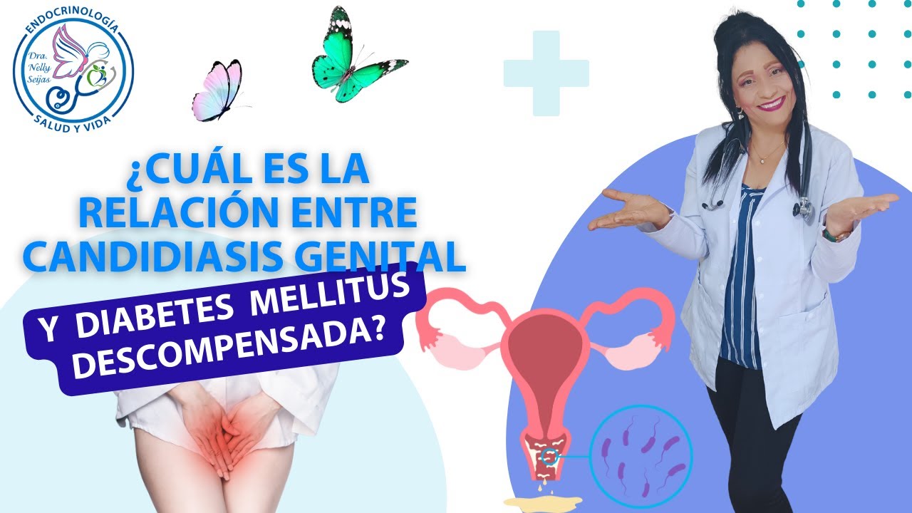 ¿Cuál es la Relación entre Candidiasis GENITAL y Diabetes Mellitus ...