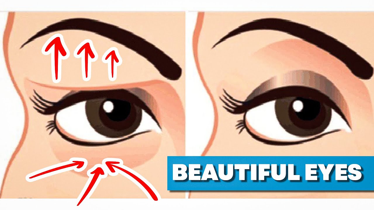 BEAUTIFUL EYES EXERCISE | Fix Eye Wrinkles, Sunken eyes, Droopy eyelids ...
