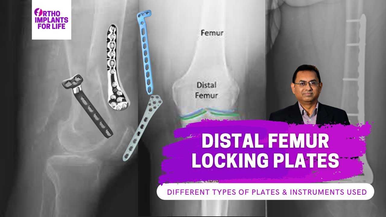 Distal Femur Locking Plates | Types of Plates & Instruments - YouTube