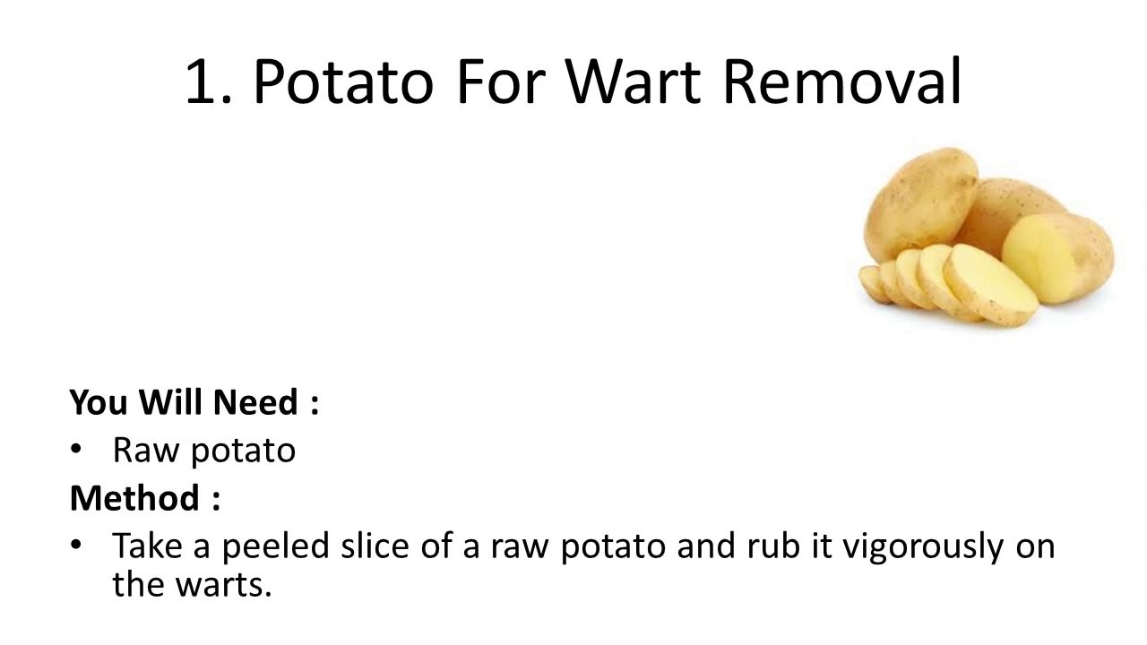 Top Ways to Remove Warts Naturally at Home | How to Get Rid of Warts ...