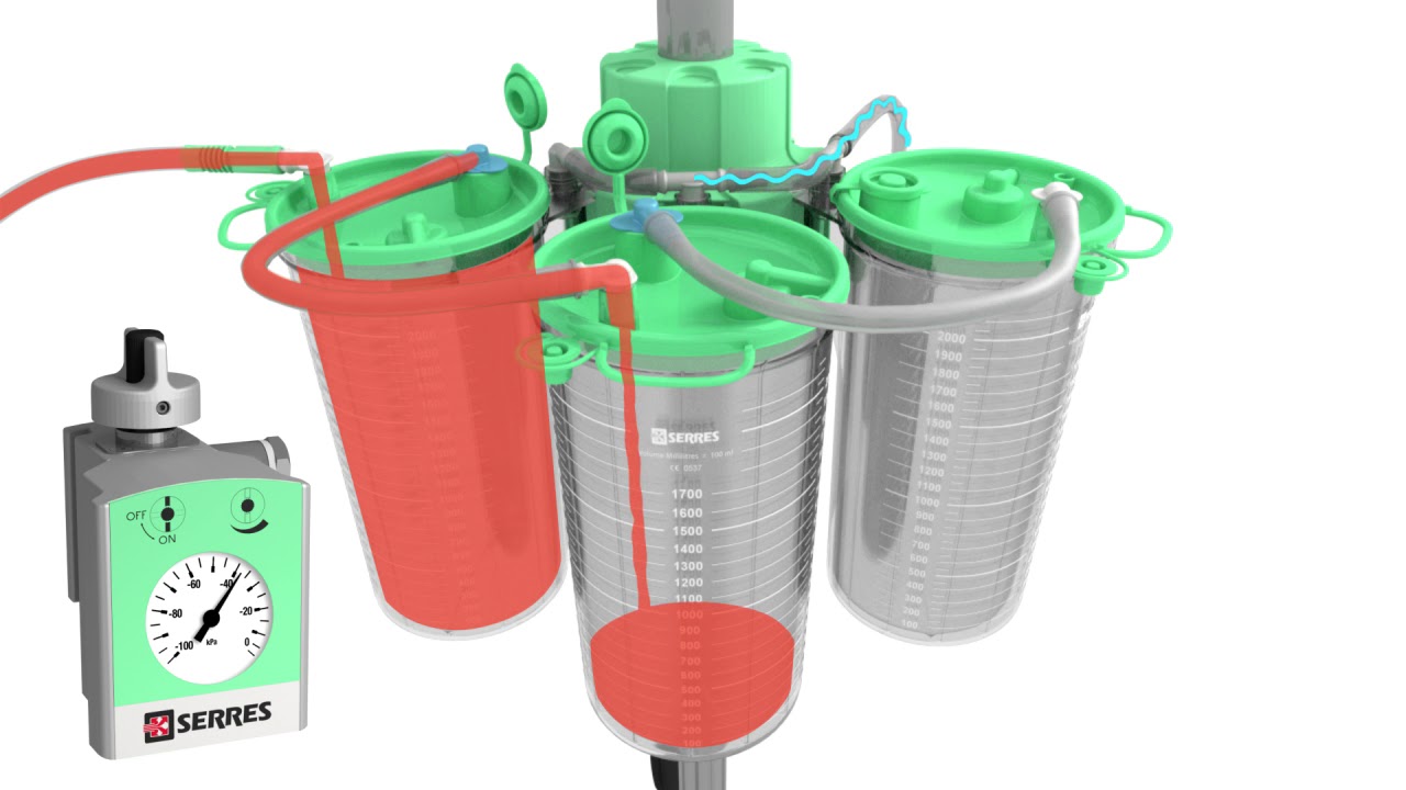How to Use Serres Suction System - YouTube