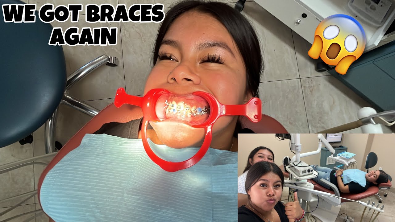 WE GOT BRACES AGAIN!!🤭(mini vlog) - YouTube