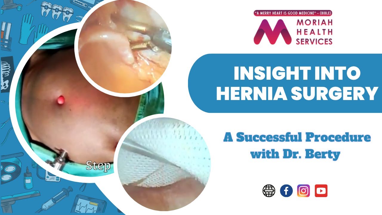 Insight into Hernia Surgery: A Successful Procedure with Dr. Berty and ...