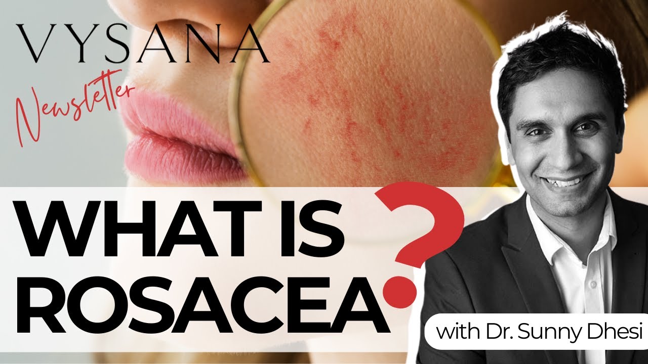 Rosacea Revealed: Managing Sensitive Skin with Dr. Sunny Dhesi | Vysana ...