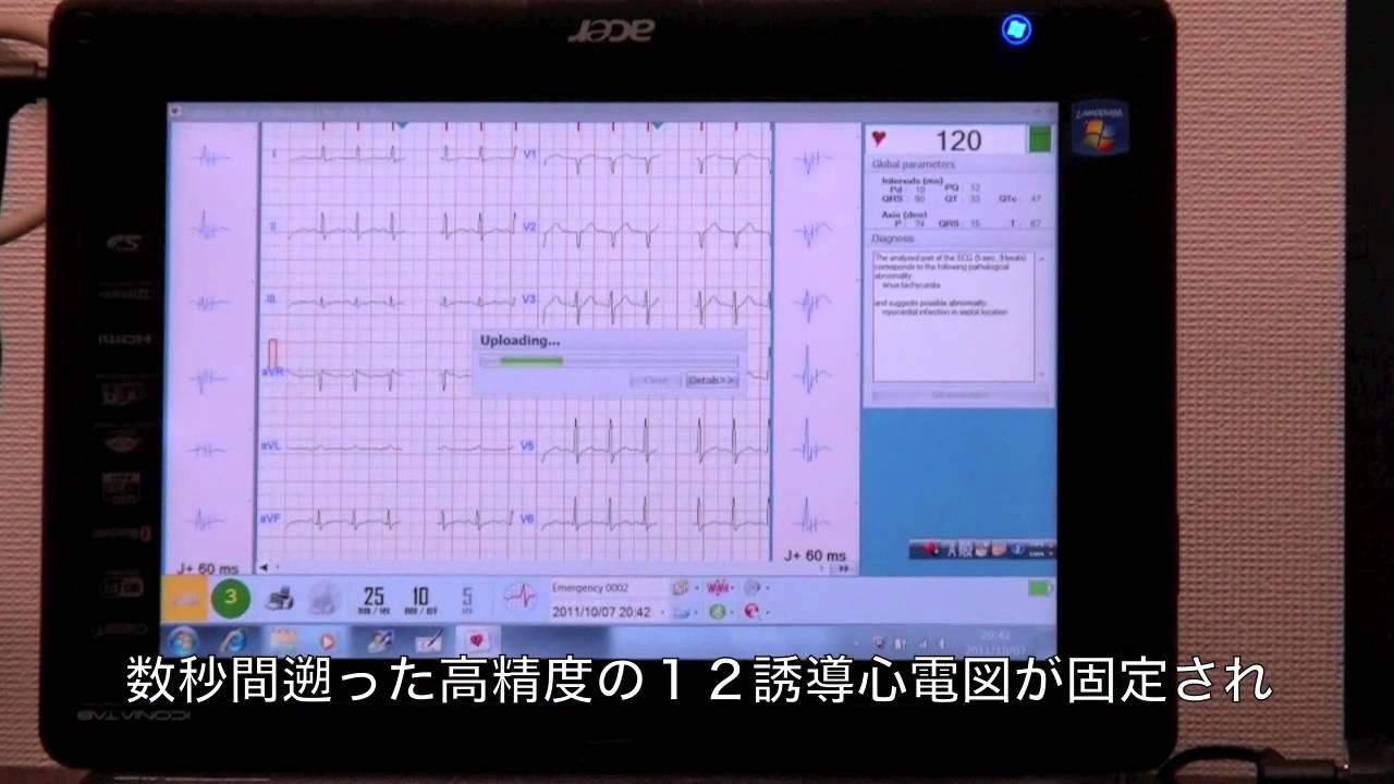 Demonstration of Mobile Cloud ECG - YouTube