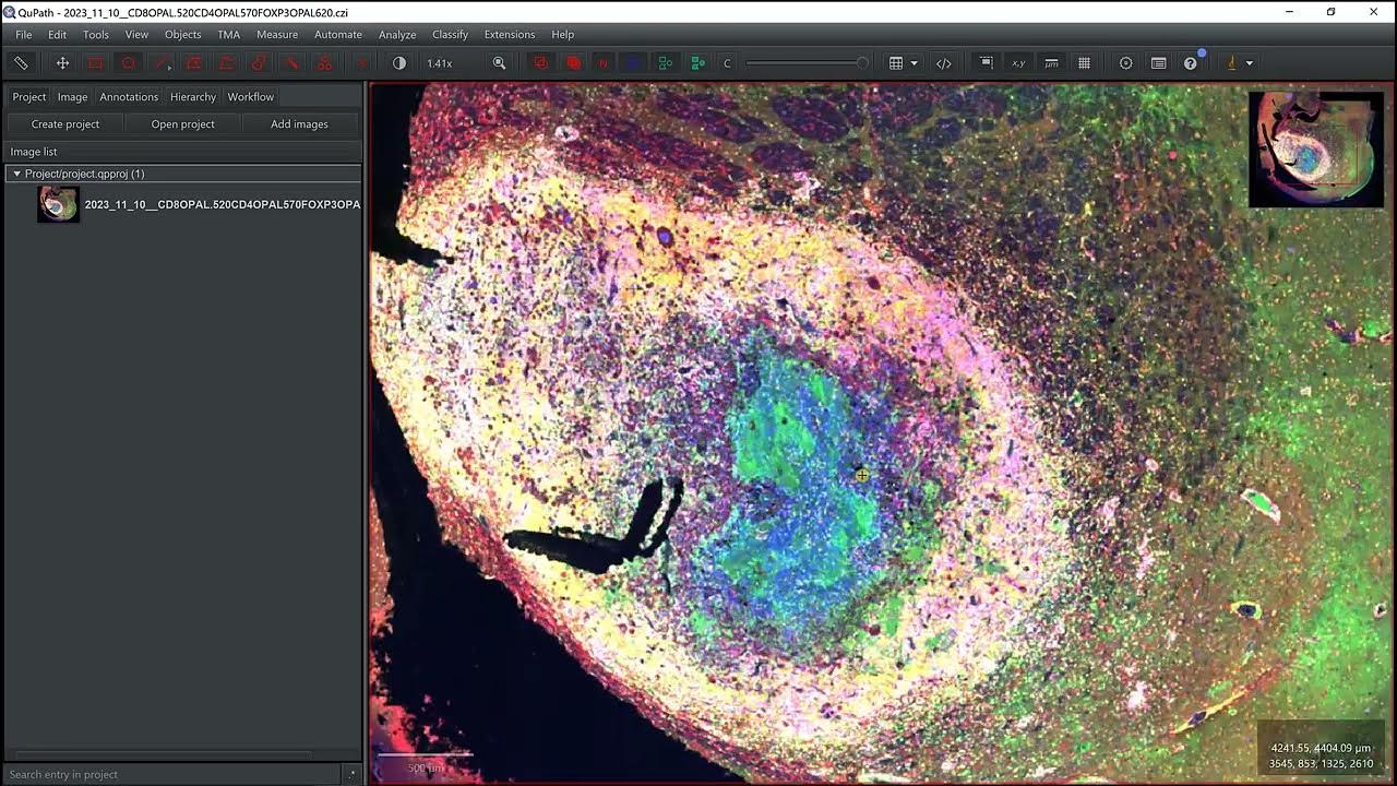 Load and visualize data with QuPath - YouTube
